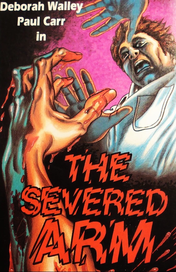 The Severed Arm (1973) – B&S About Movies